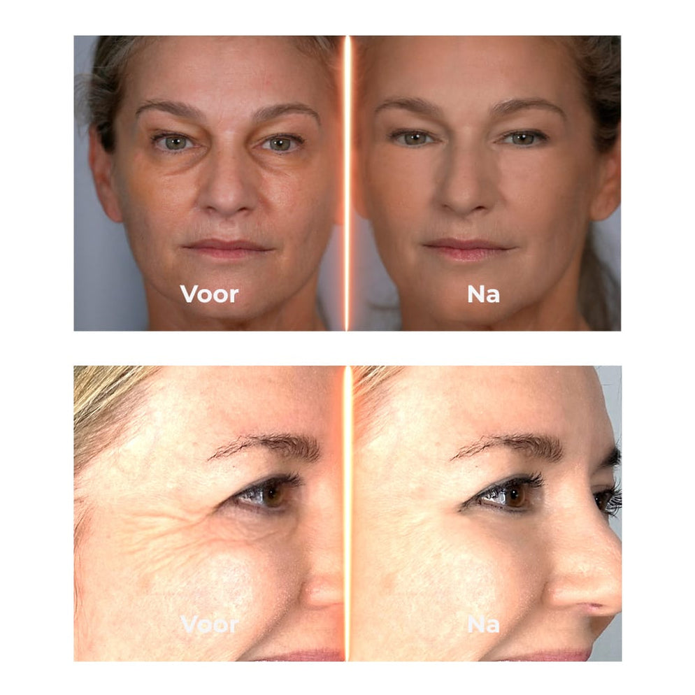 Velform Renew Collageen Maskerset met anti-aging effect